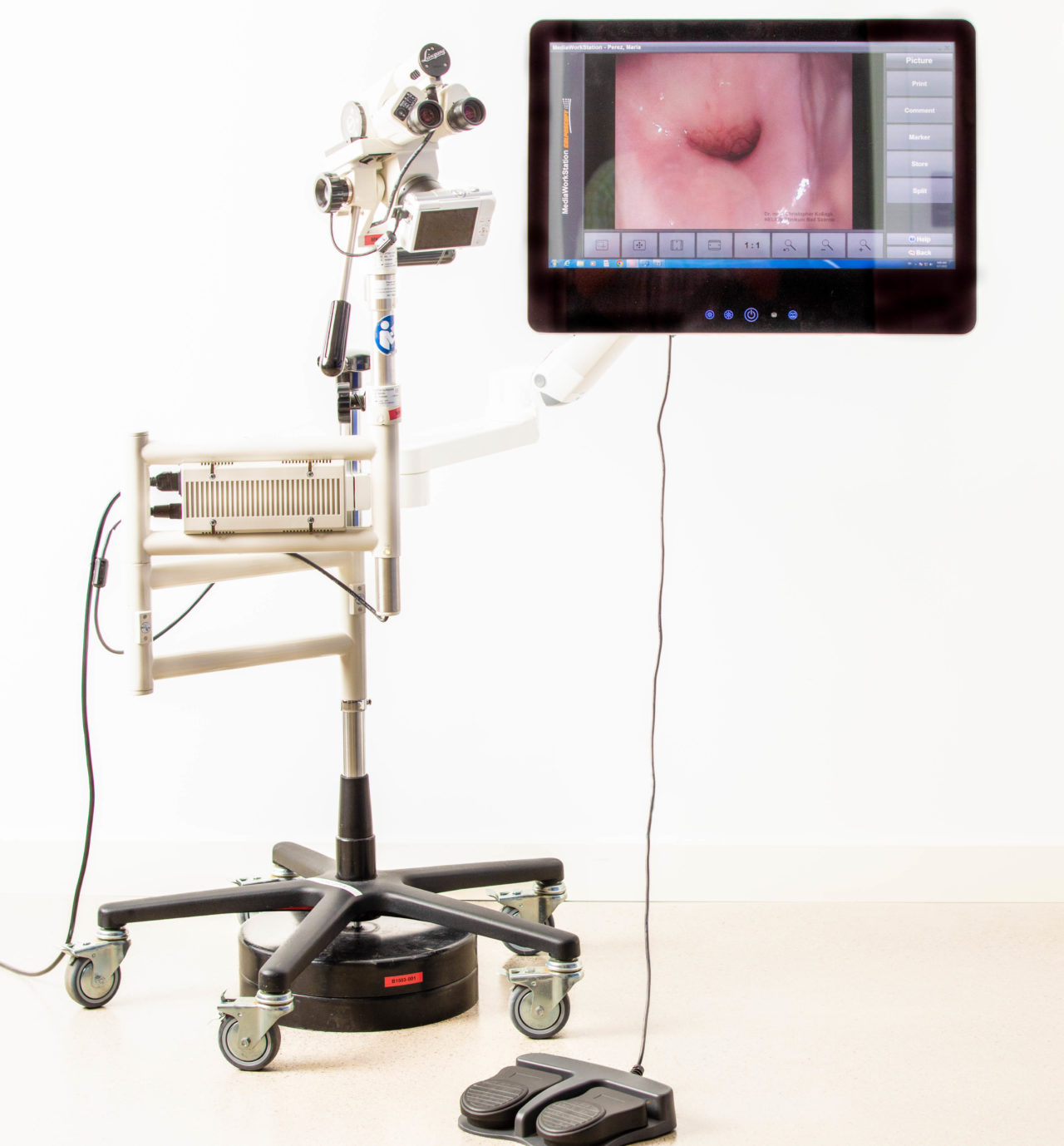 Colposcopio Leisegang 3ML LED - Leisegang Colposcopios